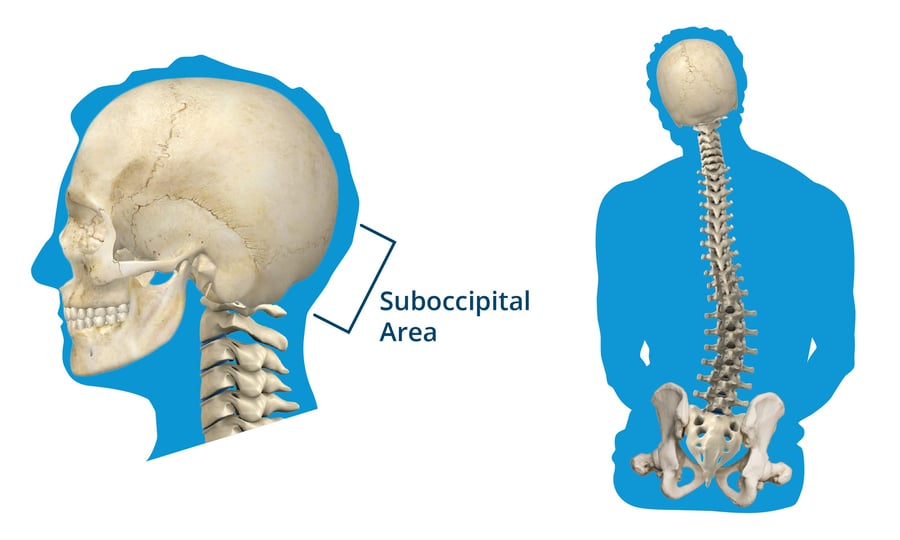 Justification for Head Supports