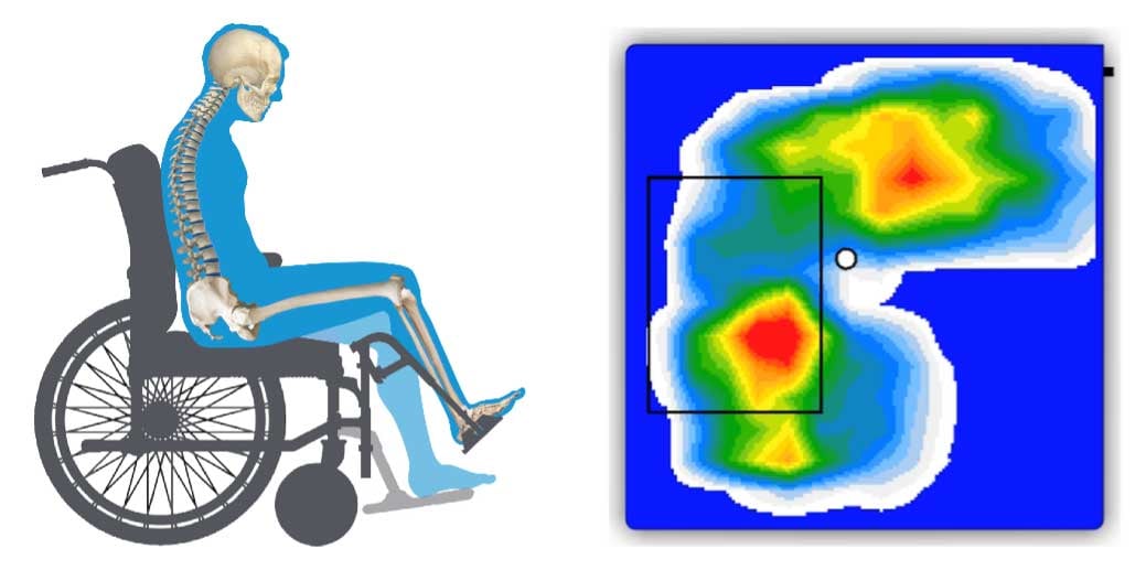 Pressure mapping seating system: collecting objective data to support ...