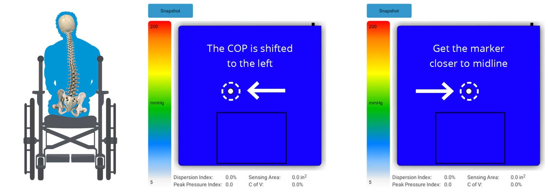 Pressure mapping seating system: a beneficial tool for biofeedback