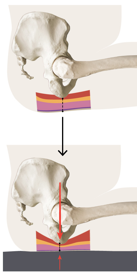 Attributes of Great Seating: Skin & Soft Tissue Protection