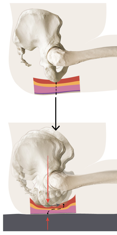 Attributes of Great Seating: Skin & Soft Tissue Protection