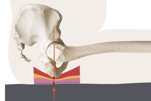 Attributes of Great Seating: Skin & Soft Tissue Protection