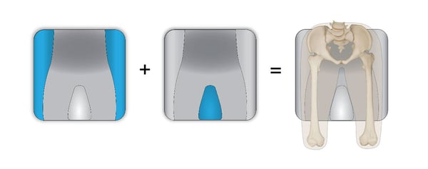 Vicair® Vector O2: Adjustable Skin Protection & Positioning Cushion