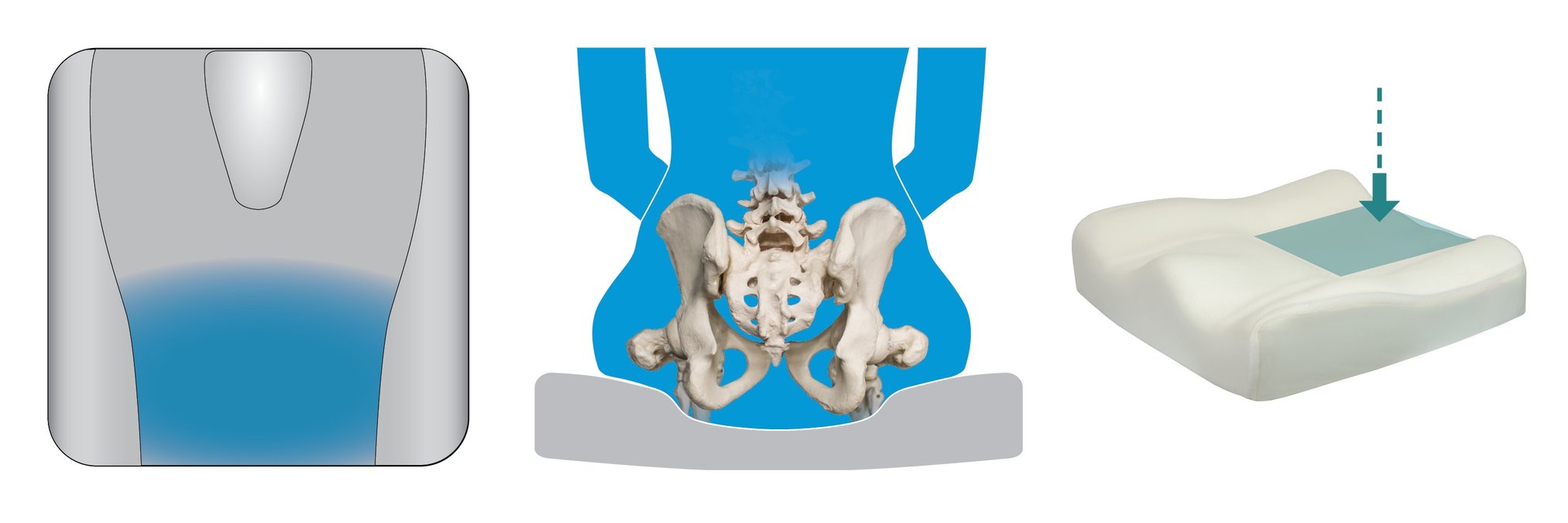 What in the construction of an offloading wheelchair cushion allows for ...