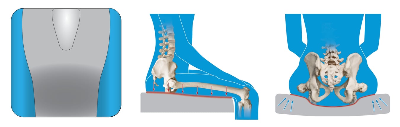 What in the construction of an offloading wheelchair cushion allows for ...