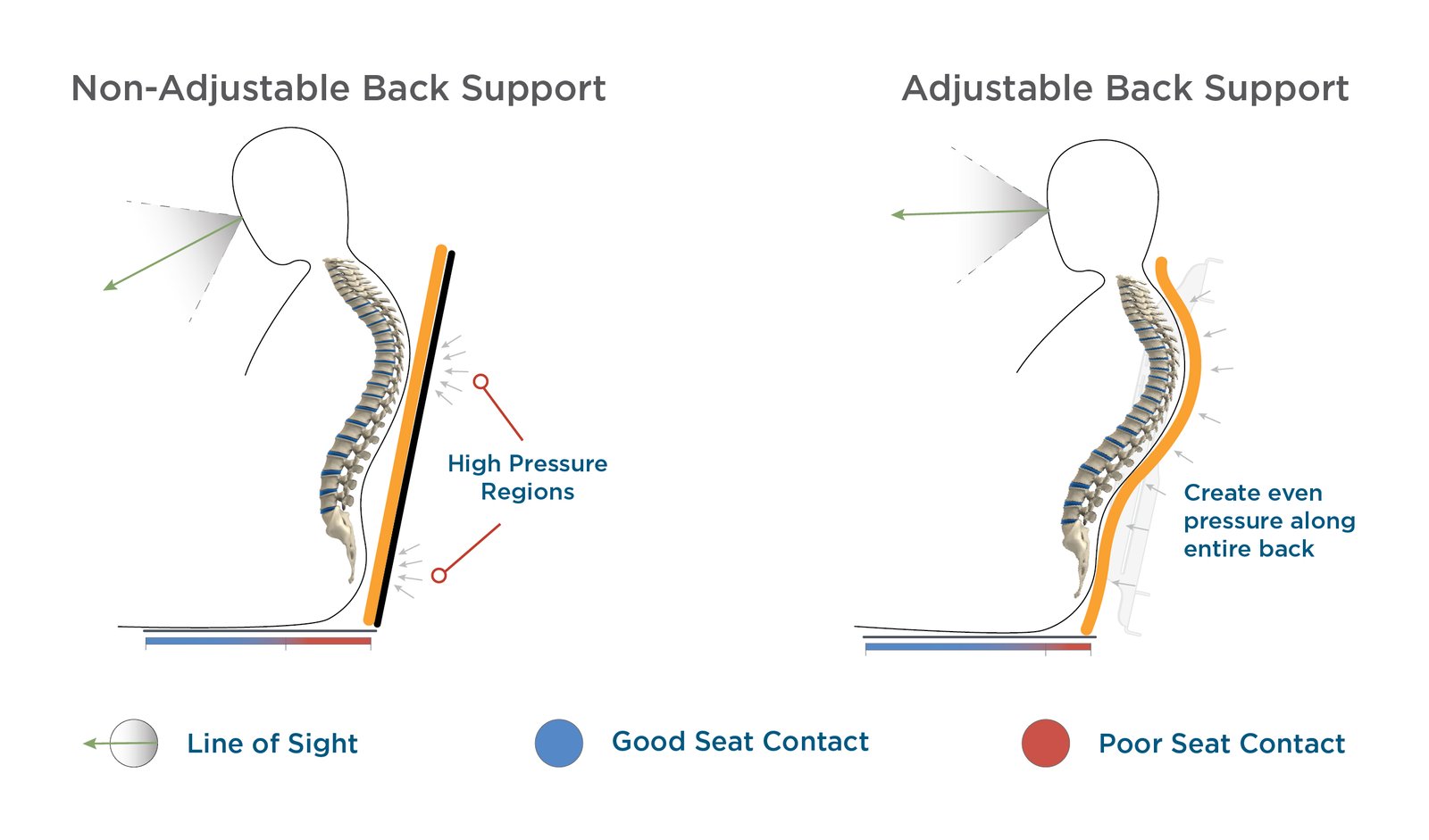 Issues with Current Wheelchair System: Back Support