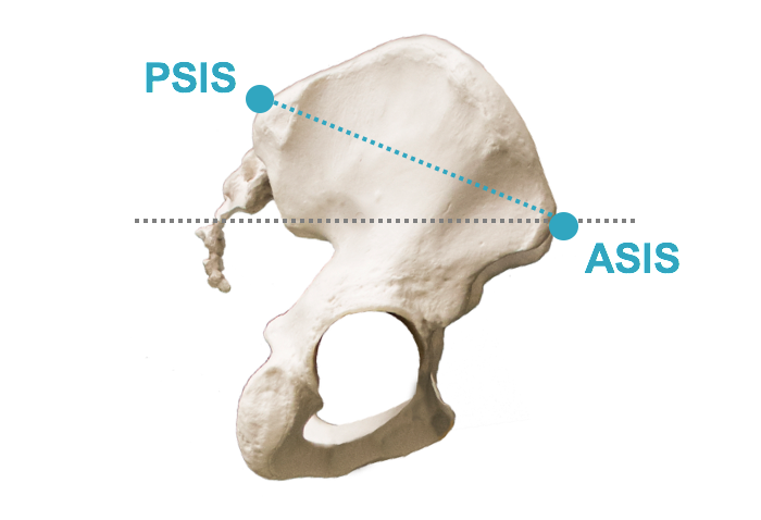 Anterior Pelvic Tilt: Palpating the Pelvis