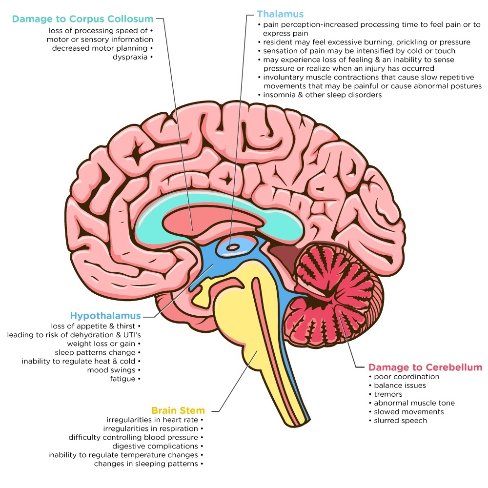 Dementia Understanding Functional Loss In Your Resident Dementia Understanding Functional Loss In Your Resident