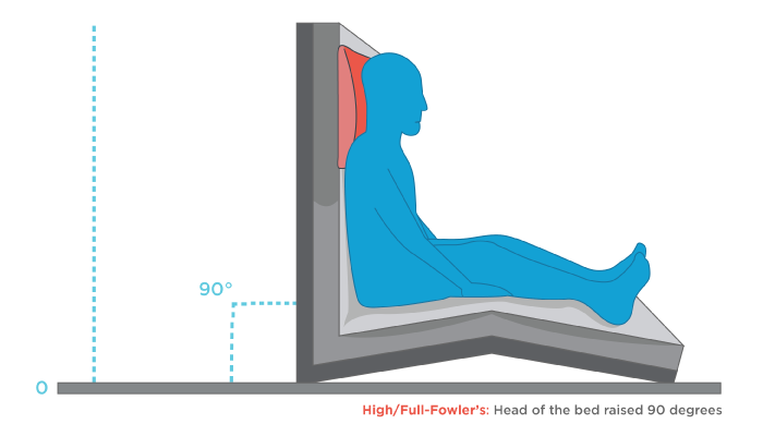 Fowler’s Position: Beyond the Bed