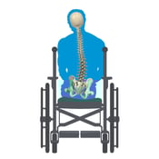 Posture Problems: How proper wheelchair positioning can prevent ...