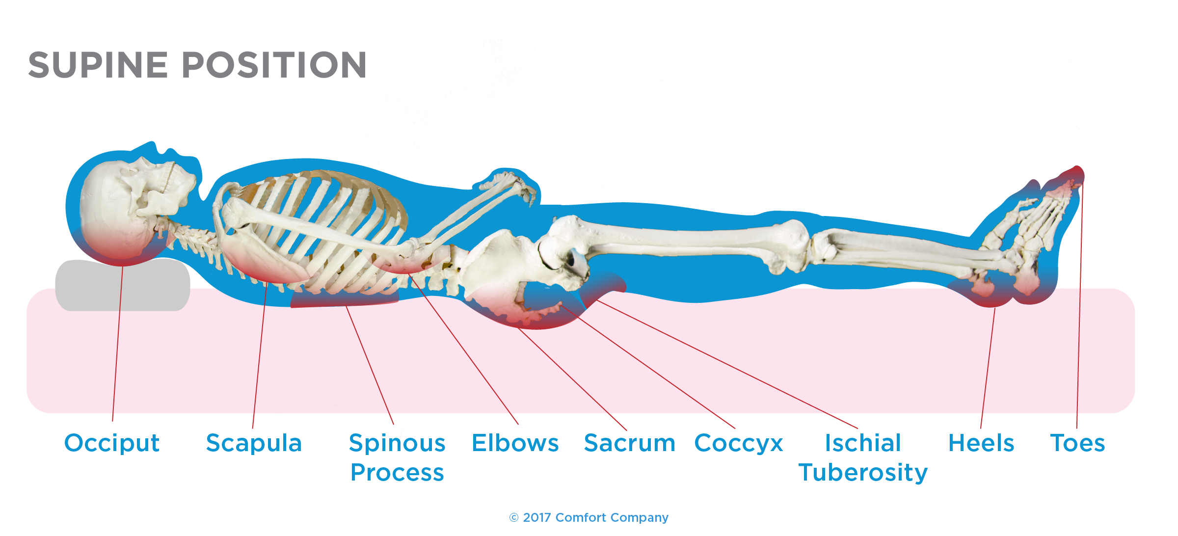 The Wheelchair Evaluation: The “Atypical” Physical Assessment