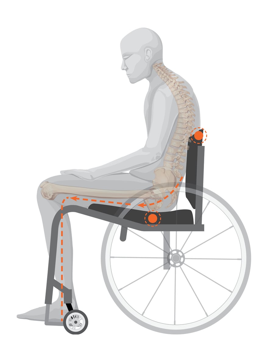 K0005 Configuration: Foot support-to-seat length and Front frame angle