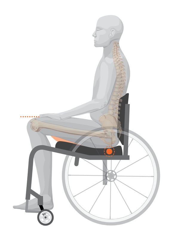 K0005 Configuration: Foot support-to-seat length and Front frame angle