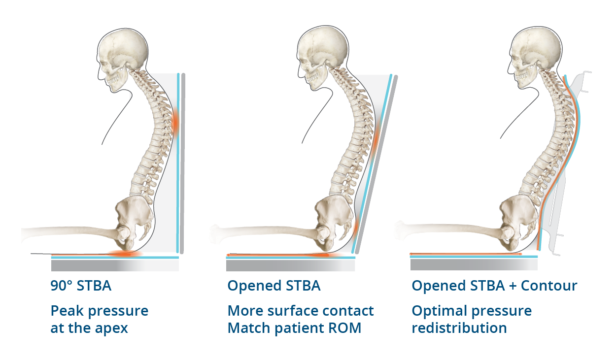 Choosing a back support: adjustability