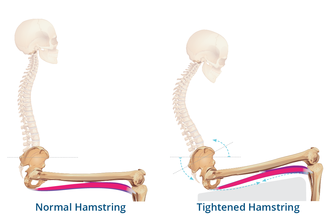 The wedge misconception