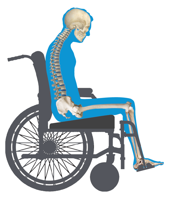 The wedge misconception